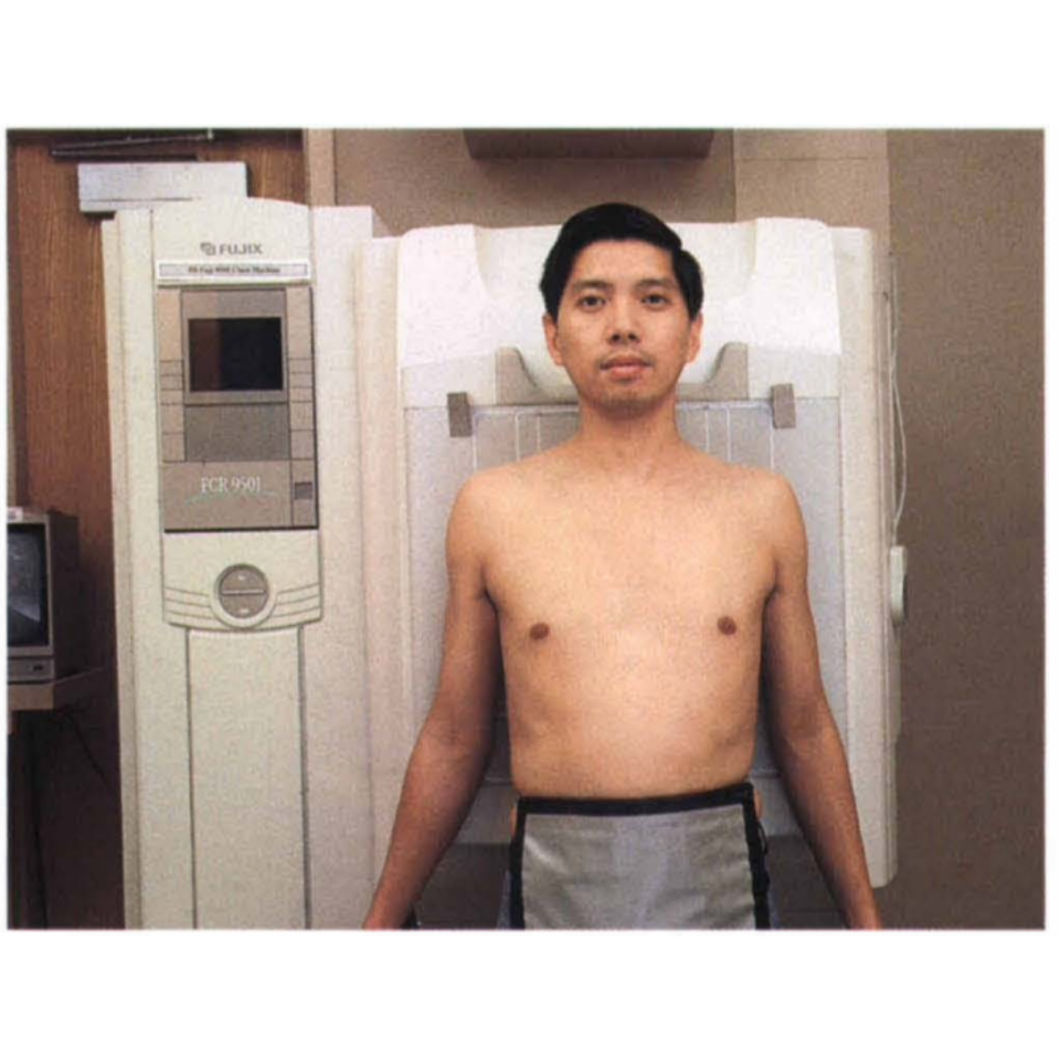 Gambaran radiograf terhadap posisi anatomi