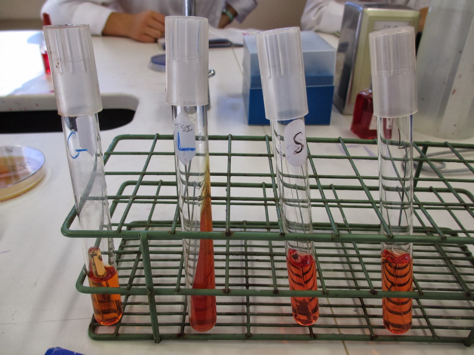 Franciscan Microbiology Lab: Test Results!!!