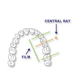 Dentistry and Medicine: Intraoral Radiographic Techniques (The ...