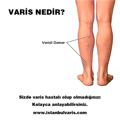 Varis Tedavi Merkezi