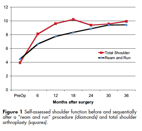 UW Shoulder and Elbow Academy: Ream and Run for Shoulder Arthritis ...
