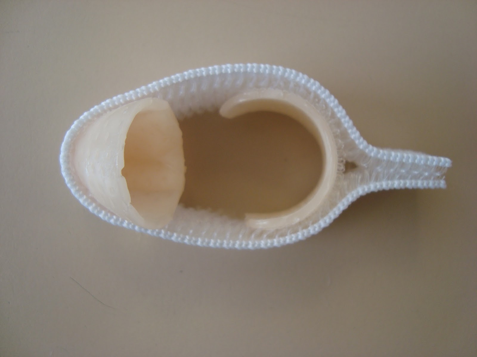 Orthèses sur mesure et appareillage personnalisé main poignet doigts ...