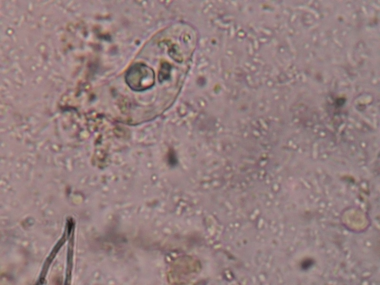 PARASITOLOGÍA: Video de trofozoito de Entamoeba invadens
