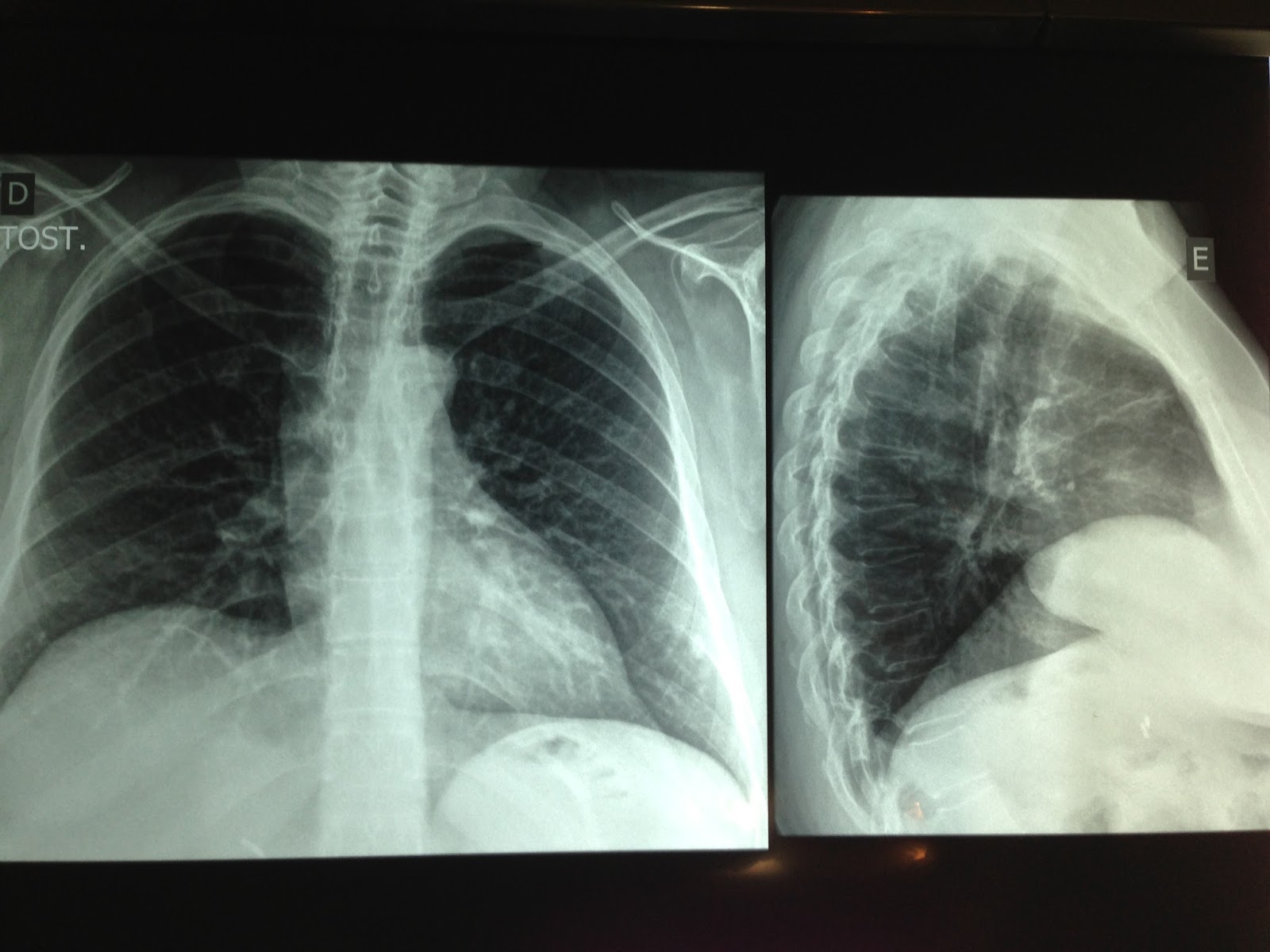 CTVA (cursos e treinamento em vias aéreas): Histórico de Via Aérea ...