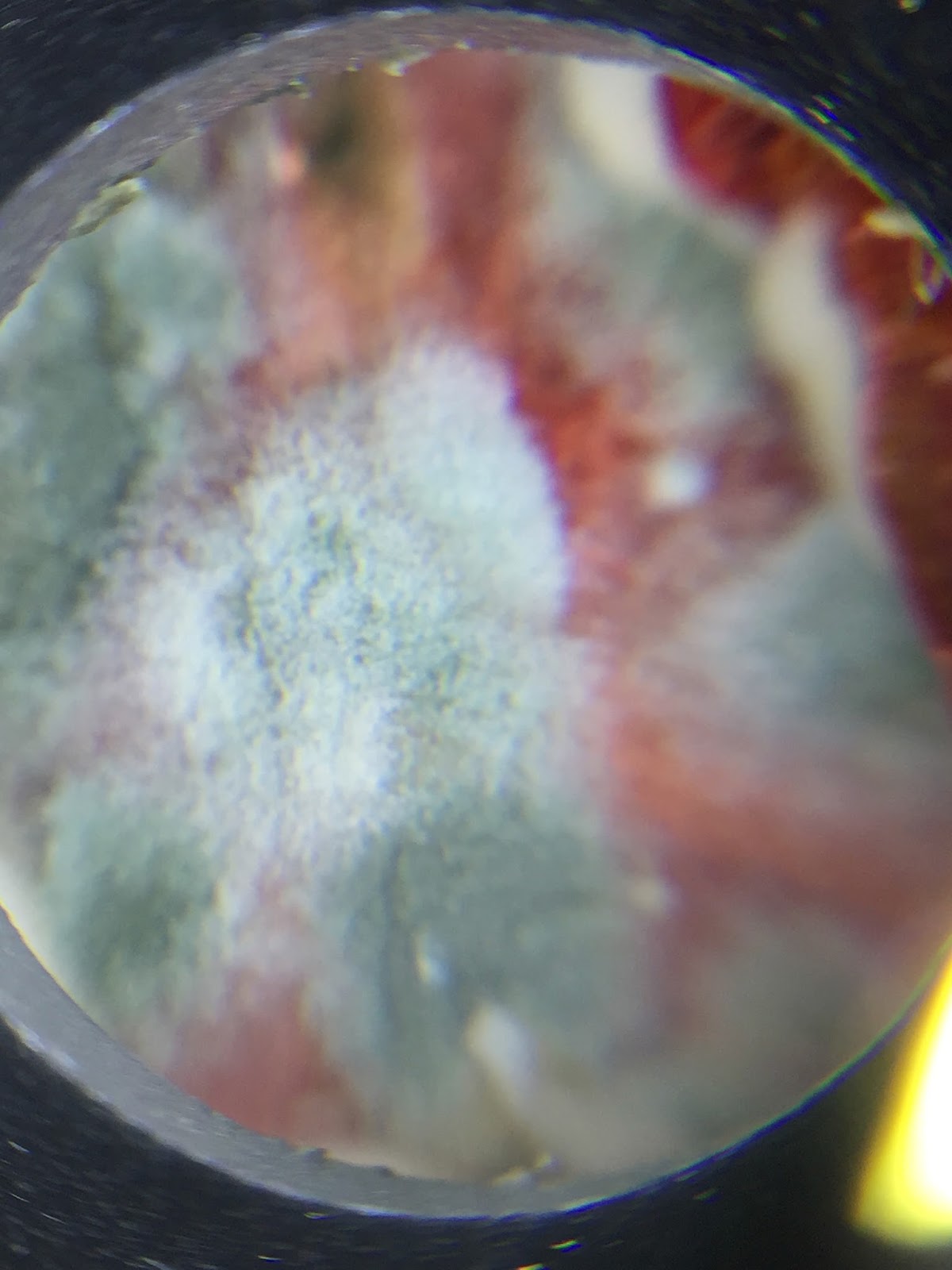 Noi della classe quinta C Ciari: Muffe: la scoperta di Fleming