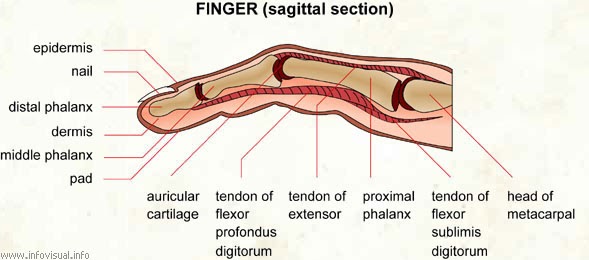 Understanding Williams Syndrome: Curved fingers and toes- Clinodactyly
