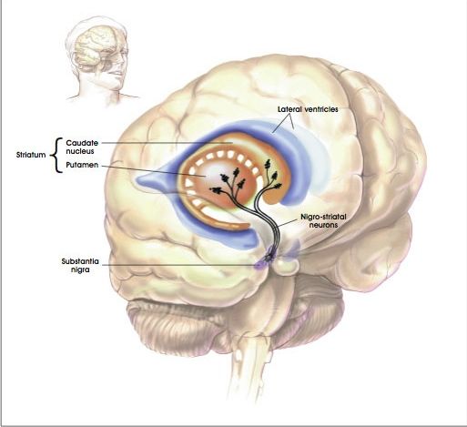 Sleep and Neurology: Parkinson's Disease: Part 1