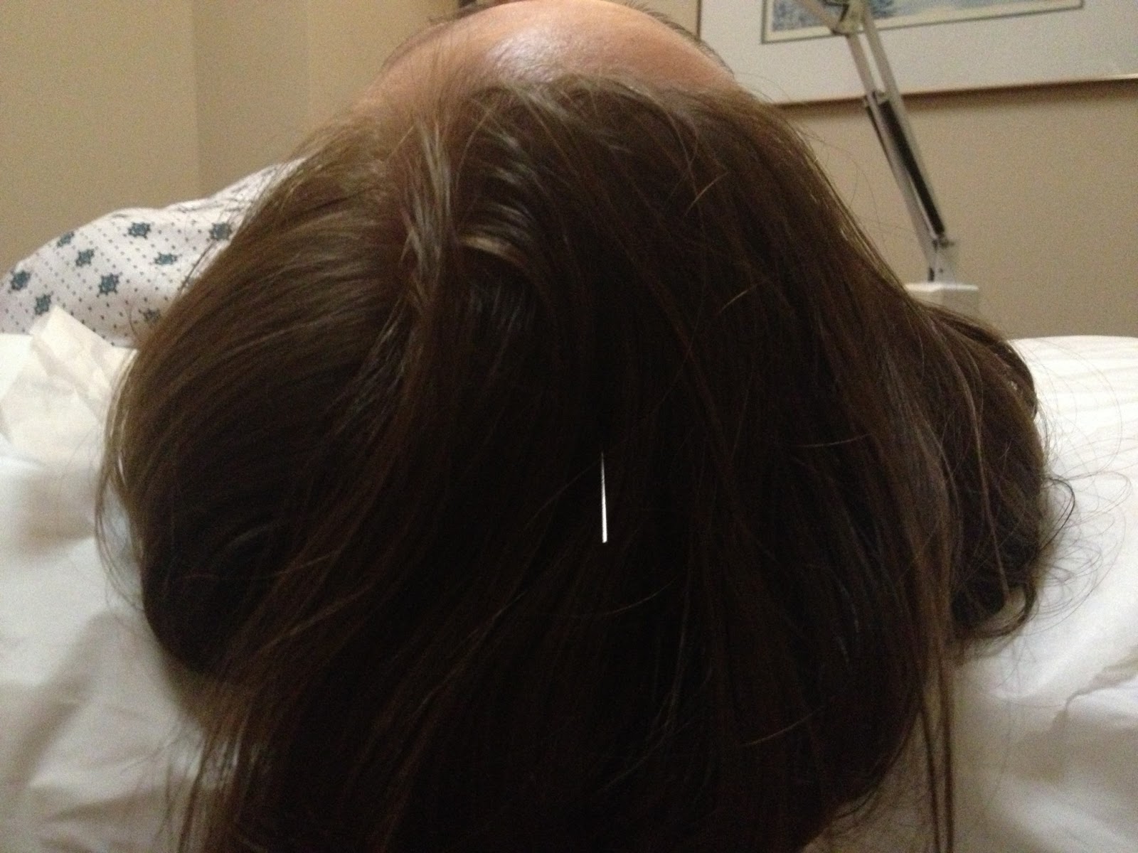 Unexplained Infertility....Explained: If at first you don't succeed ...