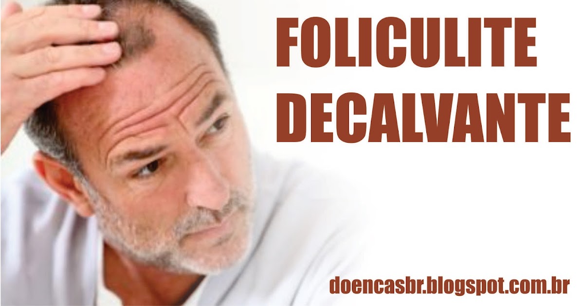Doenças BR: Foliculite Decalvante - O que é, Causas e Tratamento
