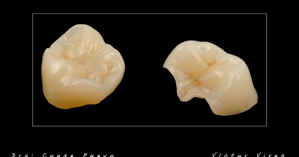 Víctor Vives: LAVA Ultimate