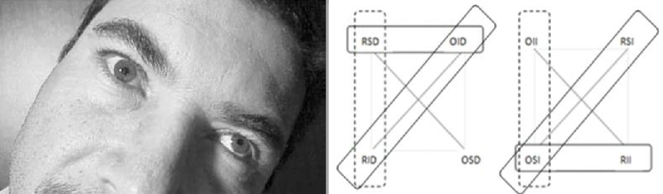 Cátedra N° 21 - Seminario N° 11 "Test de Parks"