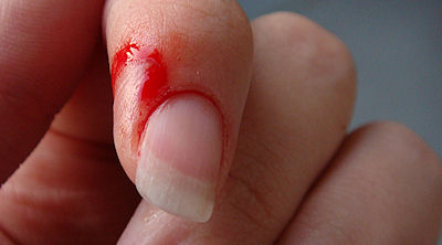 The Presurfer: Why Do Paper Cuts Hurt So Much?