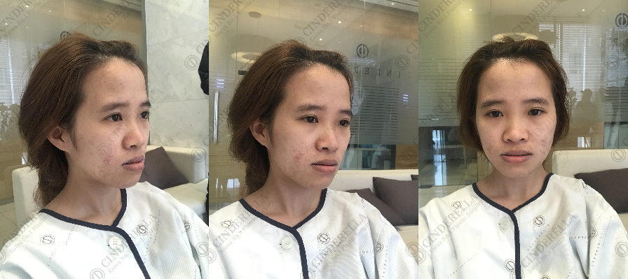 Cinderella Plastic Surgery: Cam's Real Story!