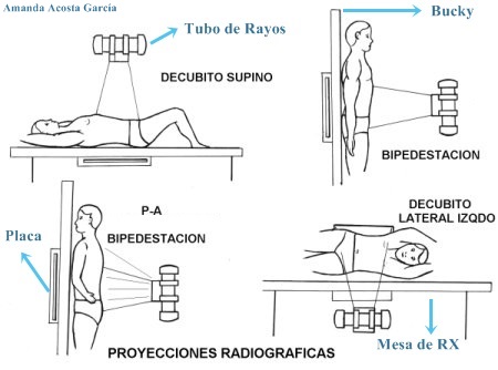 Rayos2miltrece: Proyecciones Radiológicas.
