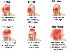 Aprenda a reconocer qué tipos de dolores de cabeza son peligrosos y ...