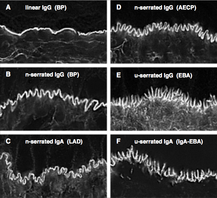 LABORATÓRIO CEAP: U-serrated immunodeposition pattern differentiates ...