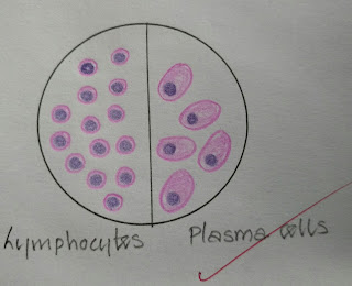 Histopathology Drawings: Lymphocytes and plasma cells
