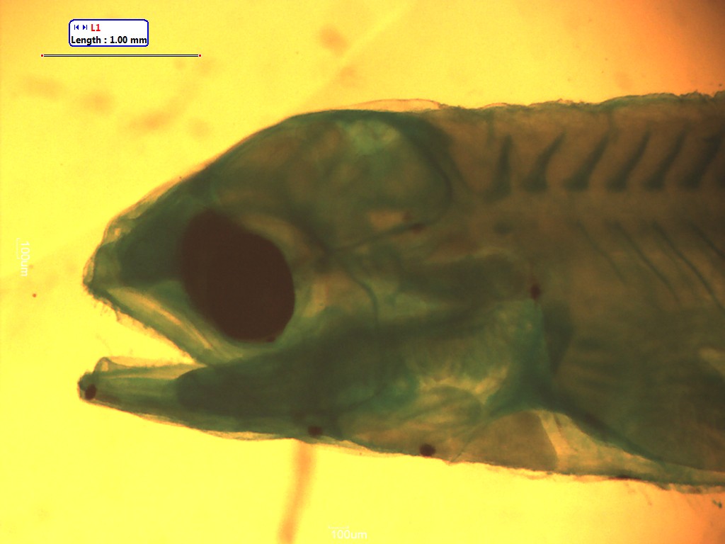 Ictioplancton en Chile: Larvas teñidas de Myctophidae / Stained larval ...