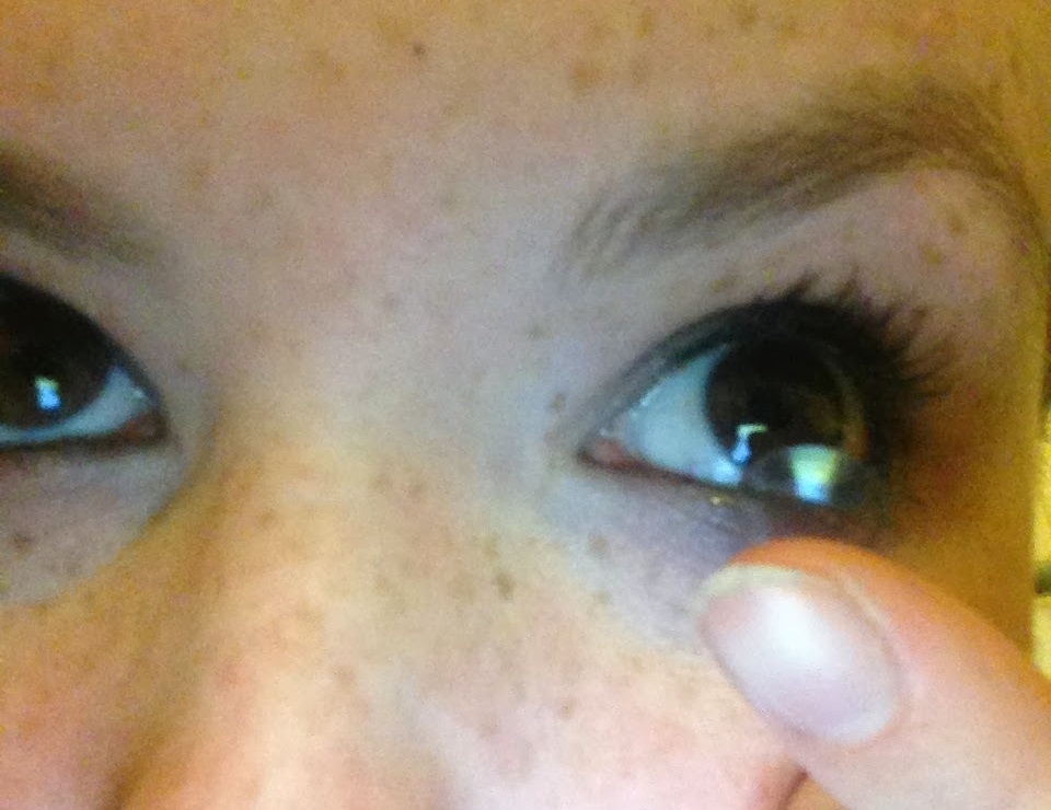 I knew something wasn't right with my eyes, but... | Keratoconus Group