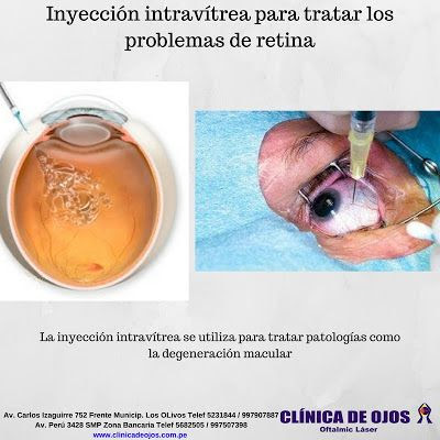 Clínica de Ojos Oftalmic Láser: Inyección intravítrea para tratar los ...