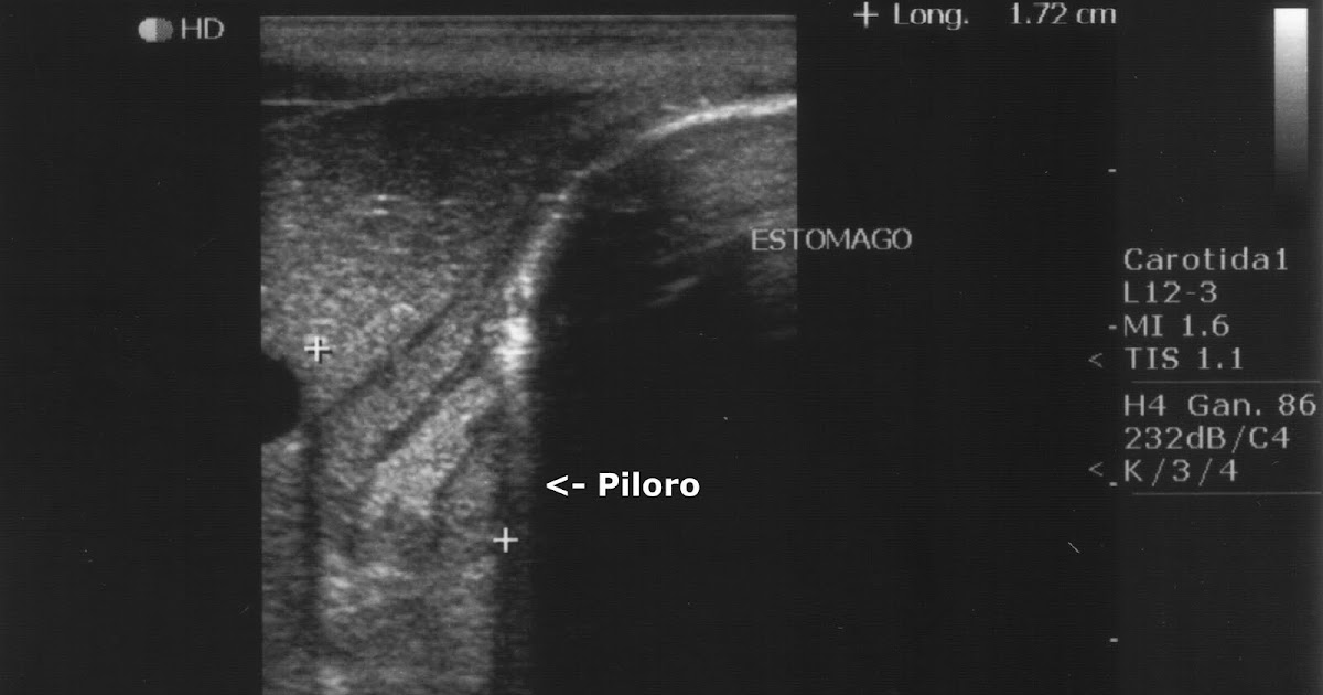 Diario de un Medico II