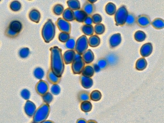 Fun With Microbiology (What's Buggin' You?): Cladosporium species ...