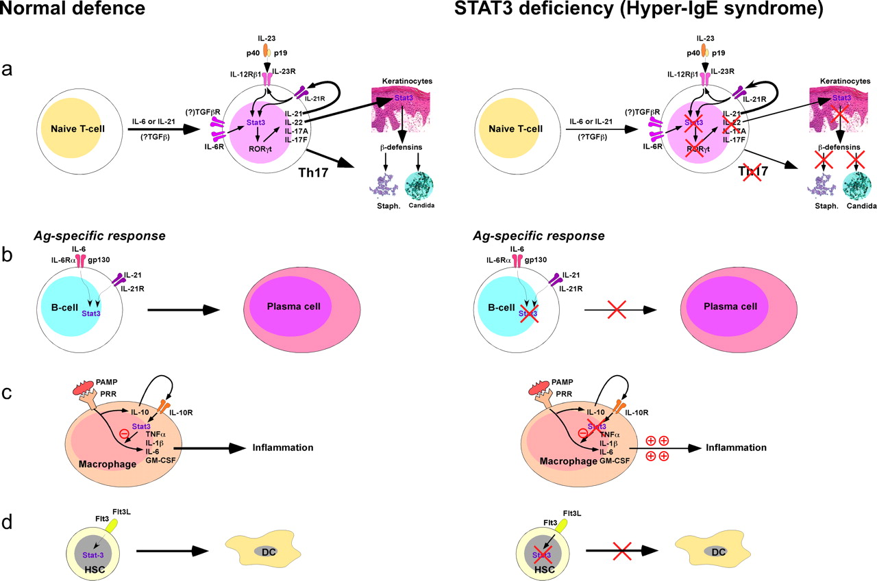 Immunology Group Posts Stat3 Mutation In Hyper Ige Syndrome From