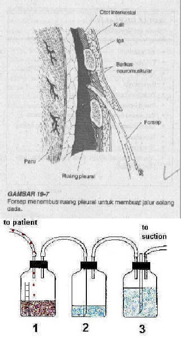 2B AKPER PEMDA GARUT