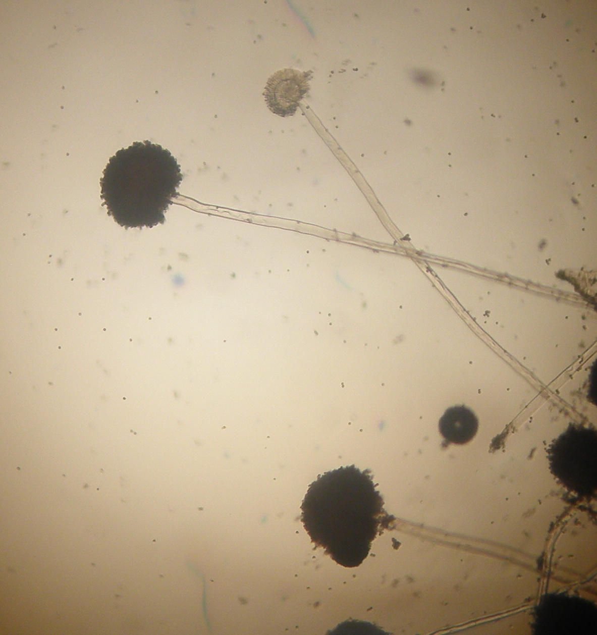 ATLAS MICOLOGIA: ASPERGILLUS NIGER