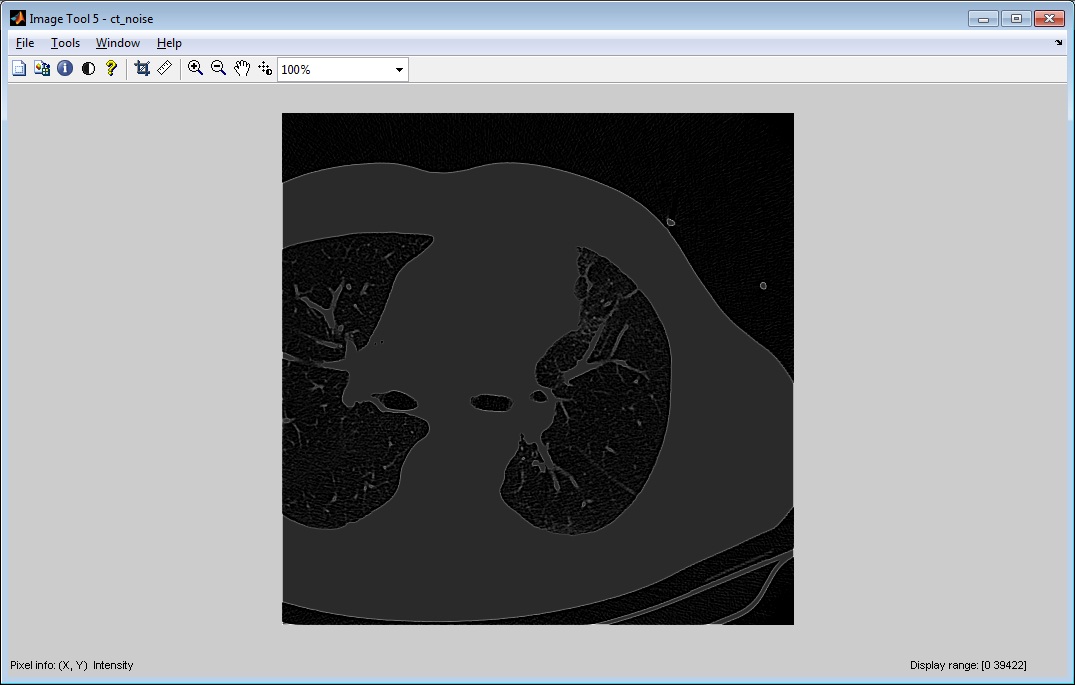 Health Informatics @ PolyU: HTI 5720 Digital Imaging and PACS ...
