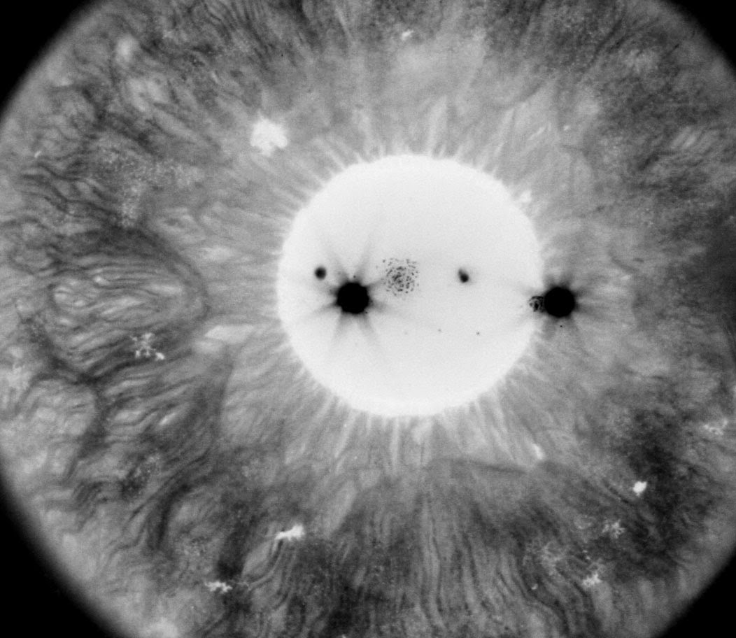 Modern & Multidimensional Iridology: The Assessment of Iris ...