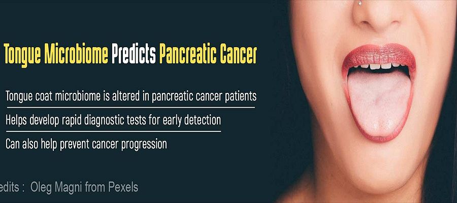 DENTAL NEWS: Tongue coating microbiome data distinguish patients with ...