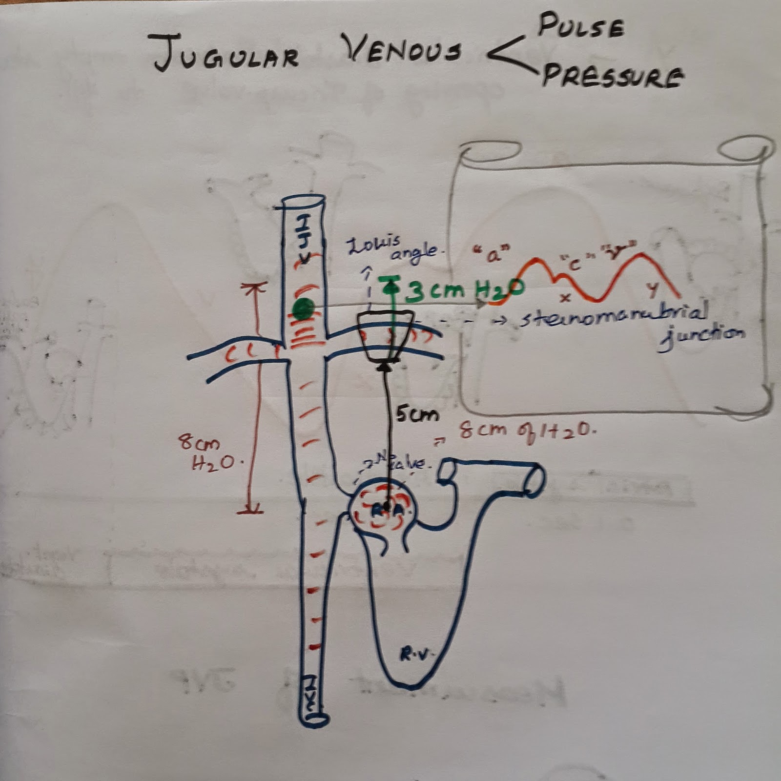 MEDGOAL: Jugular venous Pulse/Pressure ( part 2)
