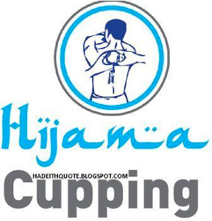 BENEFITS OF HIJAMA (CUPPING) ~ Hadith Quote