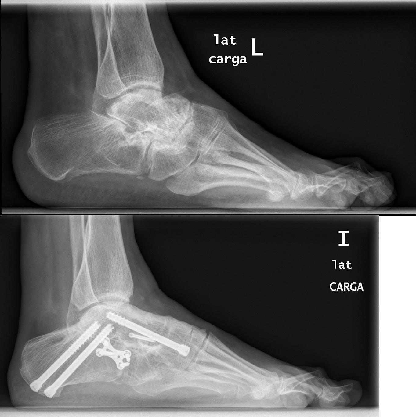 Fanáticos del pie: ATLAS DE PATOLOGIA DEL PIE: MULLER WEISS