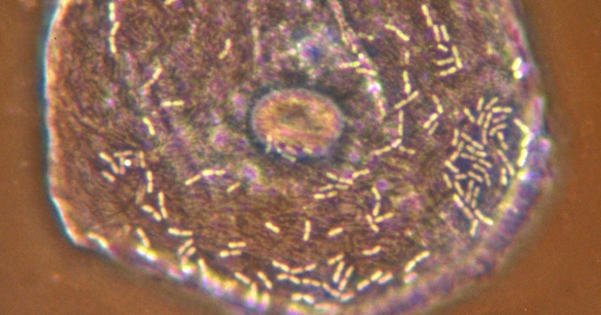 Miltoncontact: Finding low-contrast microbiological specimens under the ...