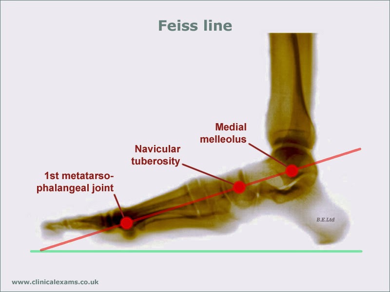 Noribel Juarez P.C. 1: Día 1. Martes 4 de Febrero
