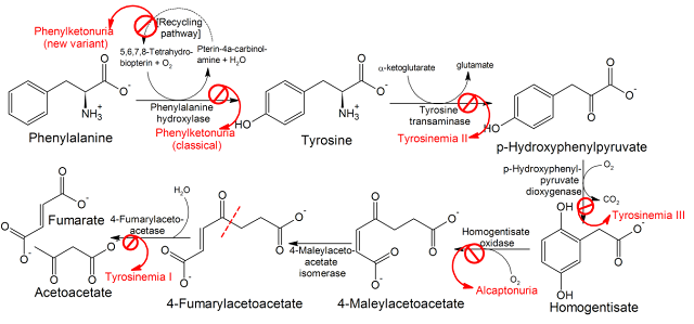 penyakit alkaptonuria