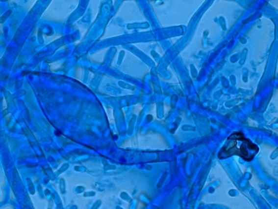 Fun With Microbiology (What's Buggin' You?): Microsporum audouinii