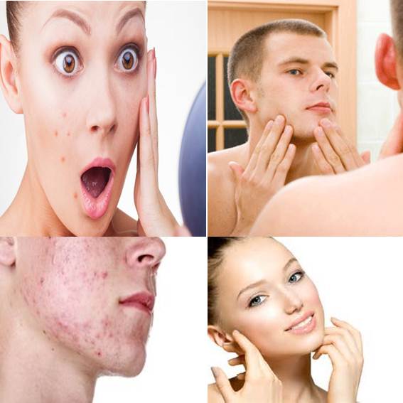 5- Pasos para tener un rostro libre de barros y espinillas. - Tendencia GQ
