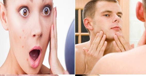 5- Pasos para tener un rostro libre de barros y espinillas. - Tendencia GQ