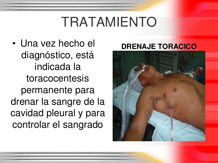 Todo sobre enfermería y medicina: Trauma de Torax