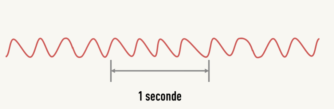 Et un peu de Neurologie: A tale of Swords and Waves - Epilepto II