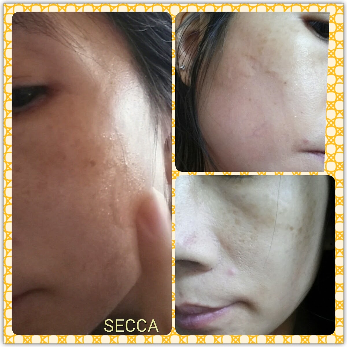 ~~~法國品牌SECCA蝸牛修復精華~~~－horuru的部落格｜痞客邦