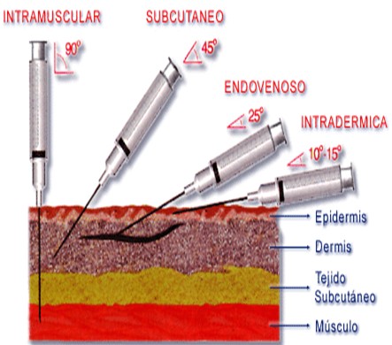 PEMBERIAN OBAT INJEKSI