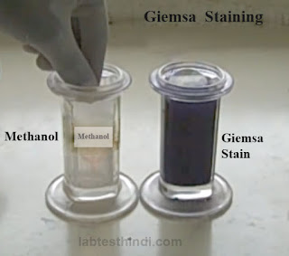 Slide Staining कैसे करते हैं – Leishman’s stain And Giemsa stain ~ Lab ...
