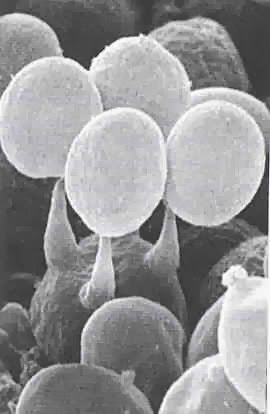 OH93 Independent study on FUNGI: Basidiomycetes