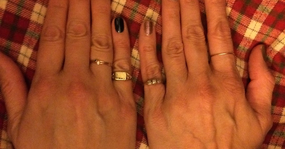 The Twins Take On: Pinky Ring Round-Up