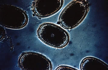 Atrigino vegus XII-1 Blog: gambar telur cacing