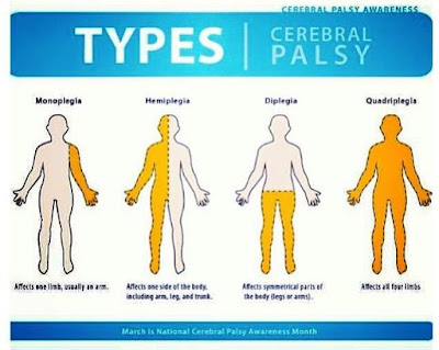 Classifications of Cerebral Palsy | Cerebral Palsy